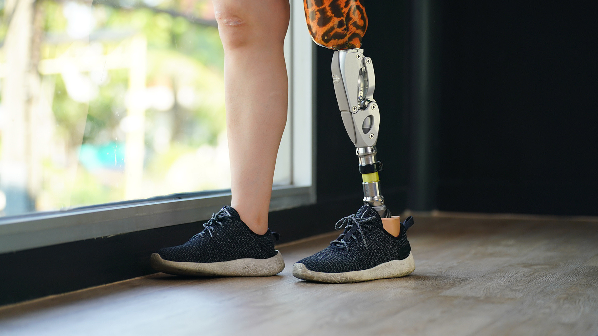 Understanding the Types of Injuries Covered in Serious Injury Claims ...